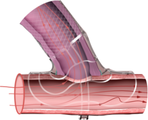 For Patients | Laminate Medical