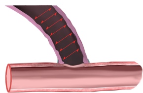 VasQ | Laminate Medical